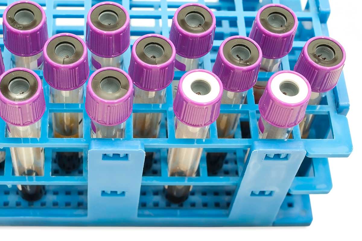 How-To’s of Managing Flow Cytometry Data - LabKey Software